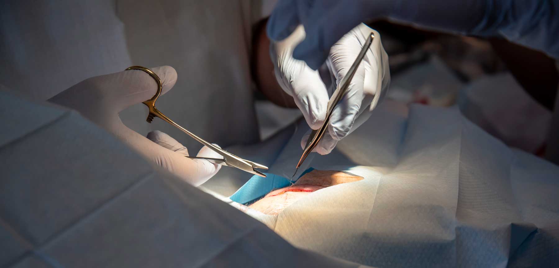 Minor Surgery - Belgrave Medical Clinic